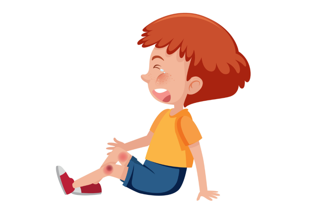 Bruising in Kids - Bootin and Savrick Pediatric Associates